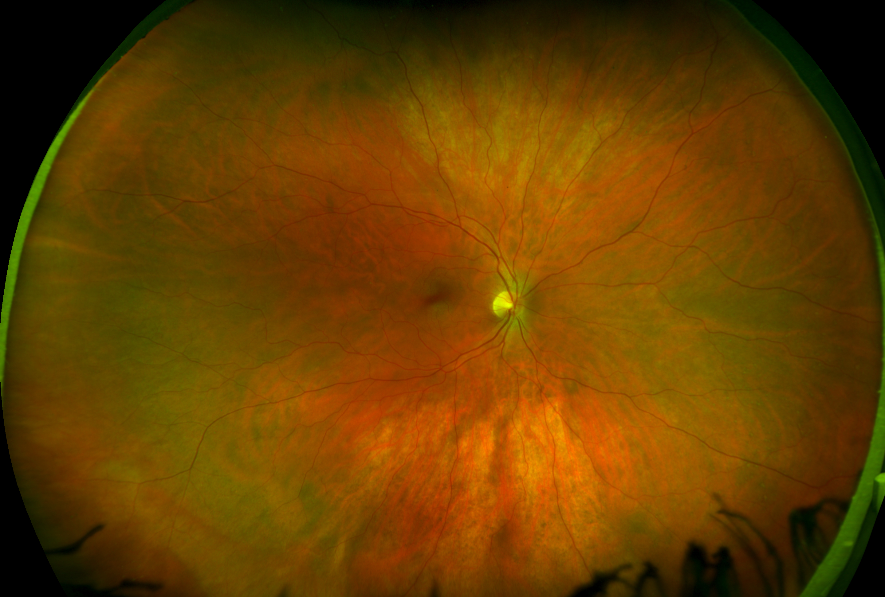 The Importance of Retinal Imaging | THE OPTICAL JEDI: A GUIDE TO THE ...